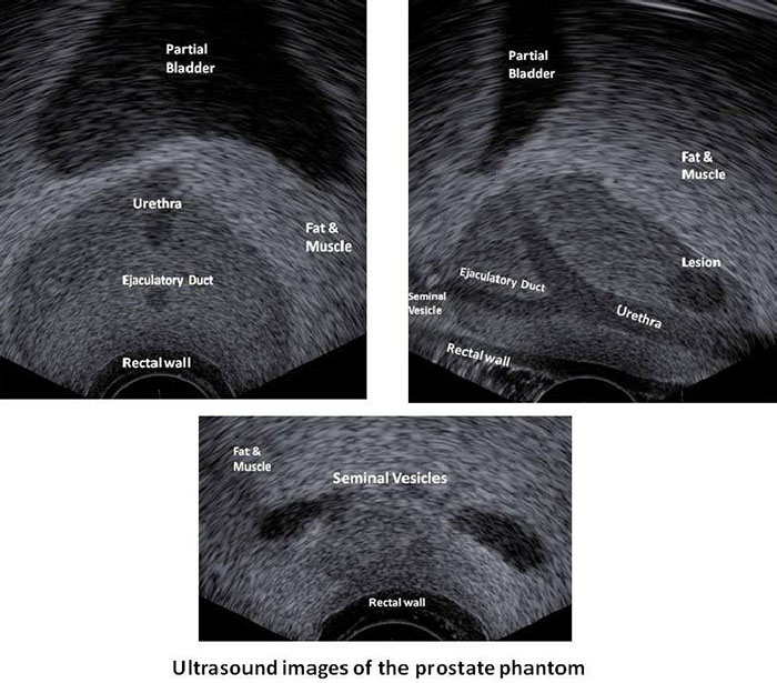Bi Plane Prostate Ultrasound Phantom S Bpnc 2 3