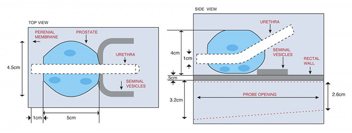 Tissue Equivalent Ultrasound Prostate Phantom Cirs 053s 053l And 053l