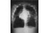 Anthropomorphic CT Phantom, PBU-60 full body, 3d torso, angiography ...