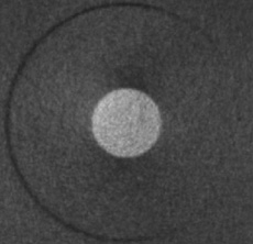 SedentexCT IQ Dental CBCT - CT Scans