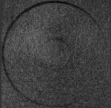 SedentexCT IQ Dental CBCT - CT Scans