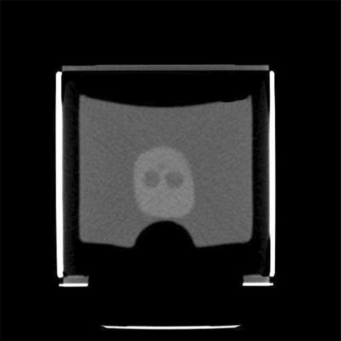 Prostate Training Phantom Ultrasound Ct Mri Cirs 070l The