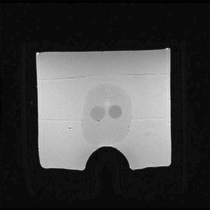Prostate Training Phantom Ultrasound Ct Mri Cirs 070l The