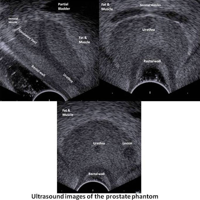 End Fire Prostate Ultrasound Phantom
